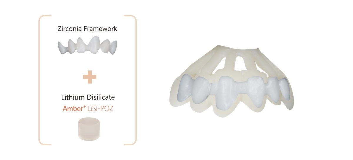 Amber: Neue Lithiumdisilikat-Glaskeramik begeistert Anwender - Dental ...
